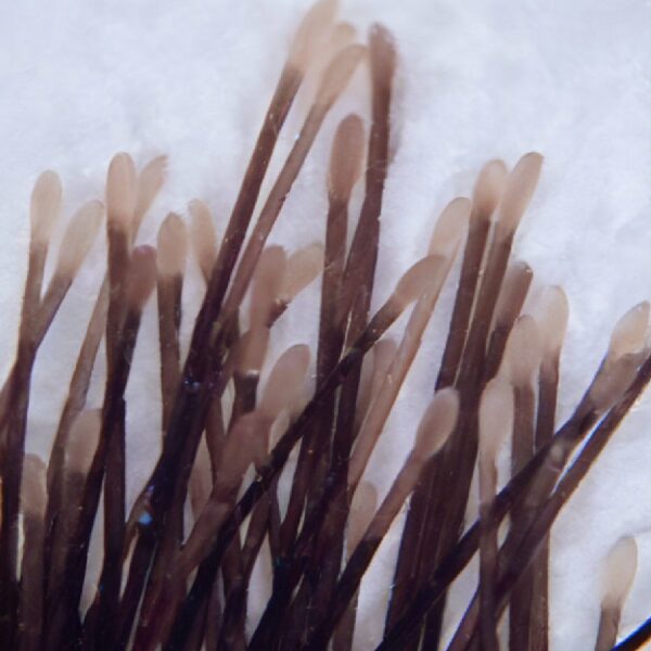 What to expect when your dermatologist asks about your hair disorder ...